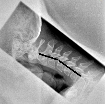 Marienstraße 3 Hannover PD Dr. Carls Orthopäde Handchirurgie Handgelenk ...